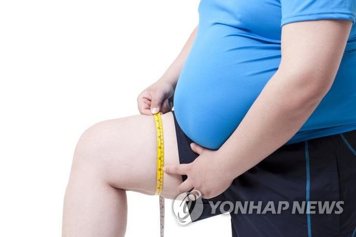 비만 여성 퇴행성 요추 질환 위험 22 높아 연합뉴스